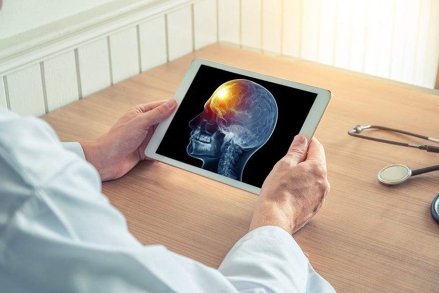 Acceleration and Deceleration Brain Injury - Boohoff Law P.A.