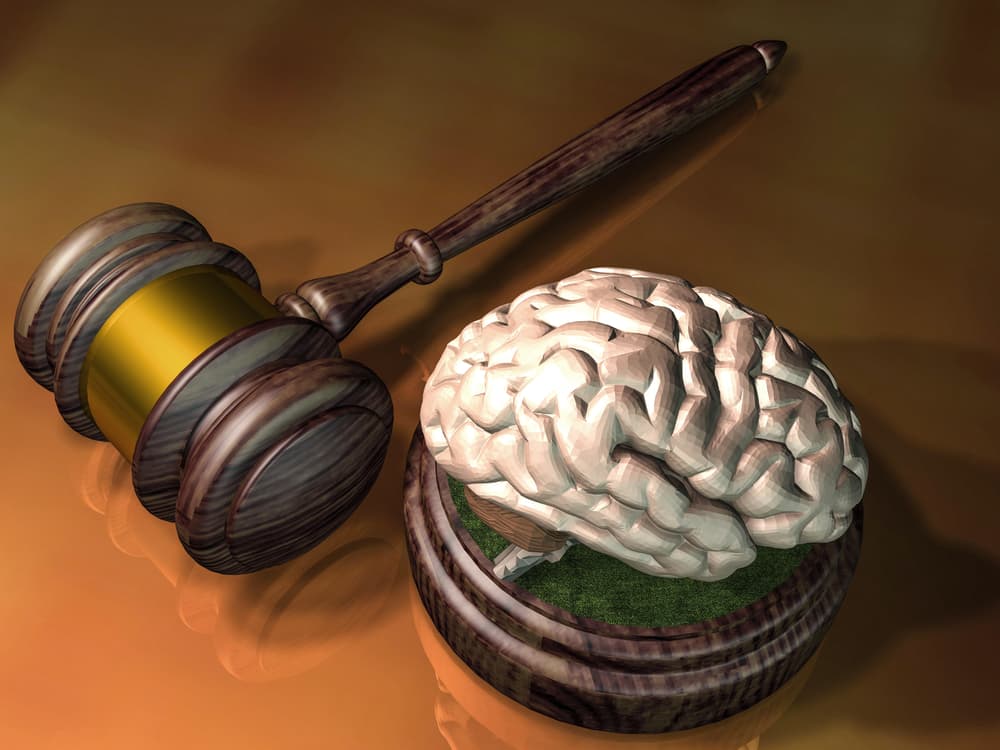 How Long Does a Brain Injury Claim Take? - Boohoff Law P.A.